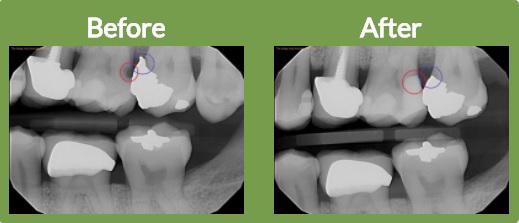 Bethlehem Town Family Dental | Blog | Problem Solved!