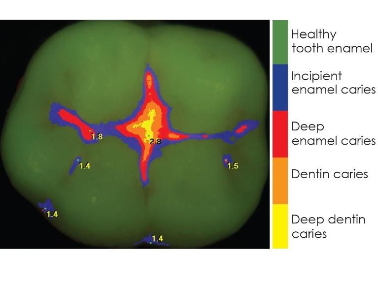 Dentist Glenmont NY | Technology | Dentist 12077